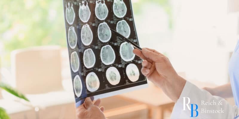 Delayed Concussion Symptoms | Houston Brain Injury Lawyer